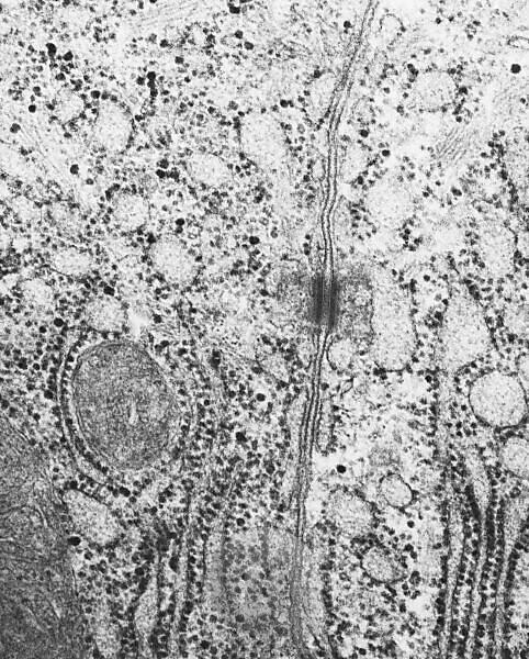 Ribosomes Electron Micrograph